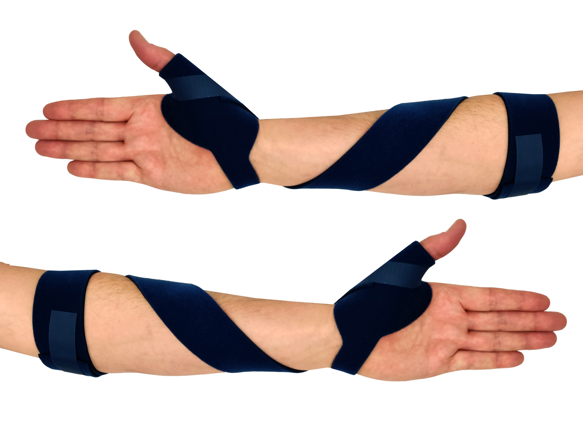 McKie Supination Strap & Thumb Splint Bundle (Adult Sizes) - McKie Splints