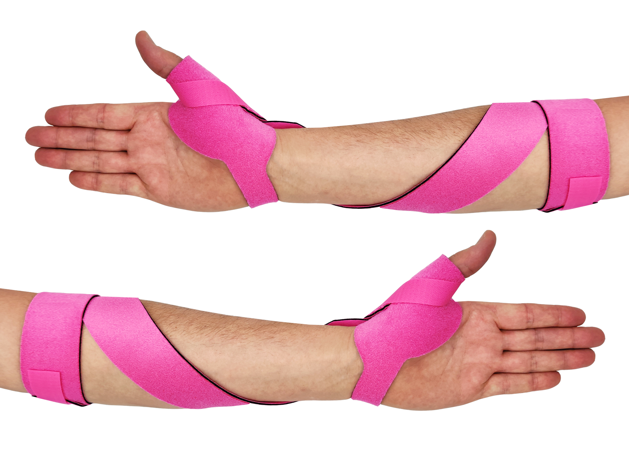 McKie Supination Strap & Thumb Splint Bundle (Adult Sizes) - McKie Splints
