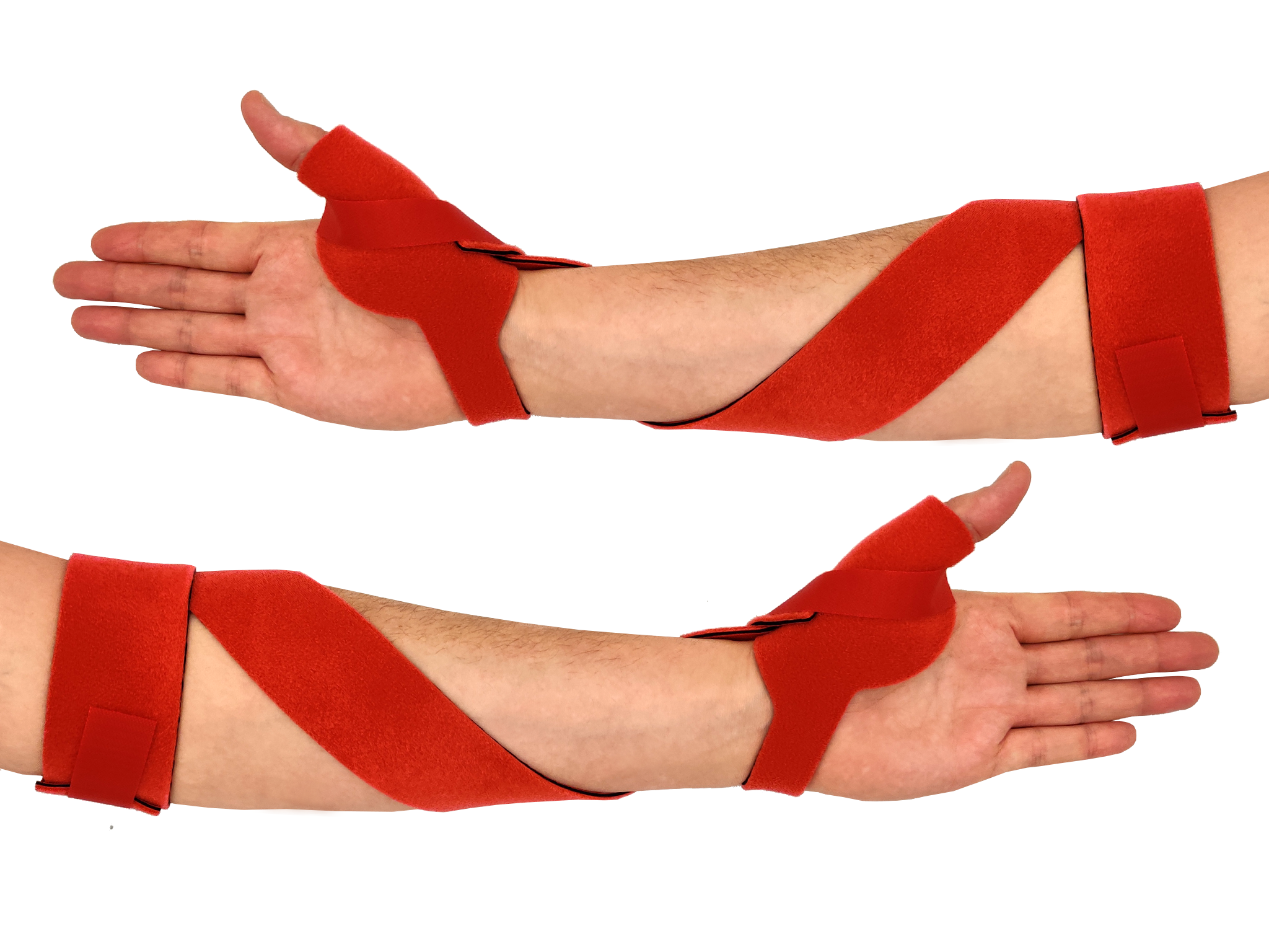 McKie Supination Strap & Thumb Splint Bundle (Adult Sizes) - McKie Splints