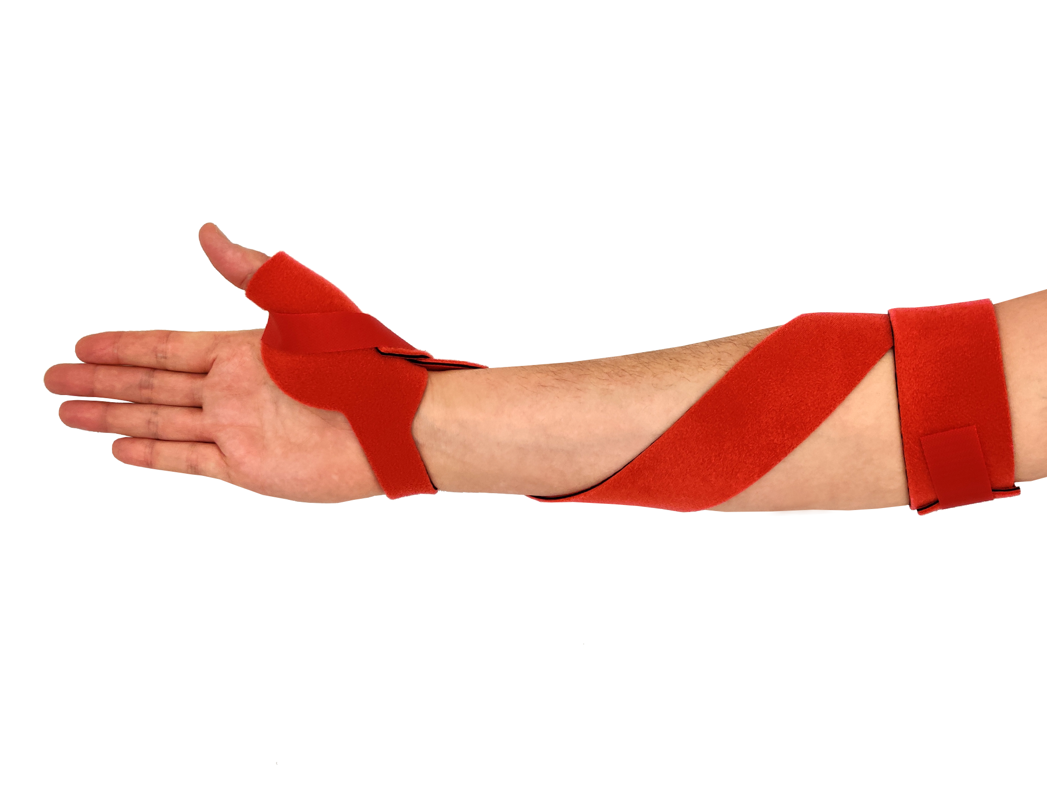 McKie Supination Strap & Thumb Splint Bundle (Adult Sizes) - McKie Splints