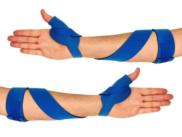 McKie Supination Strap & Thumb Splint Bundle (Adult Sizes) - McKie Splints