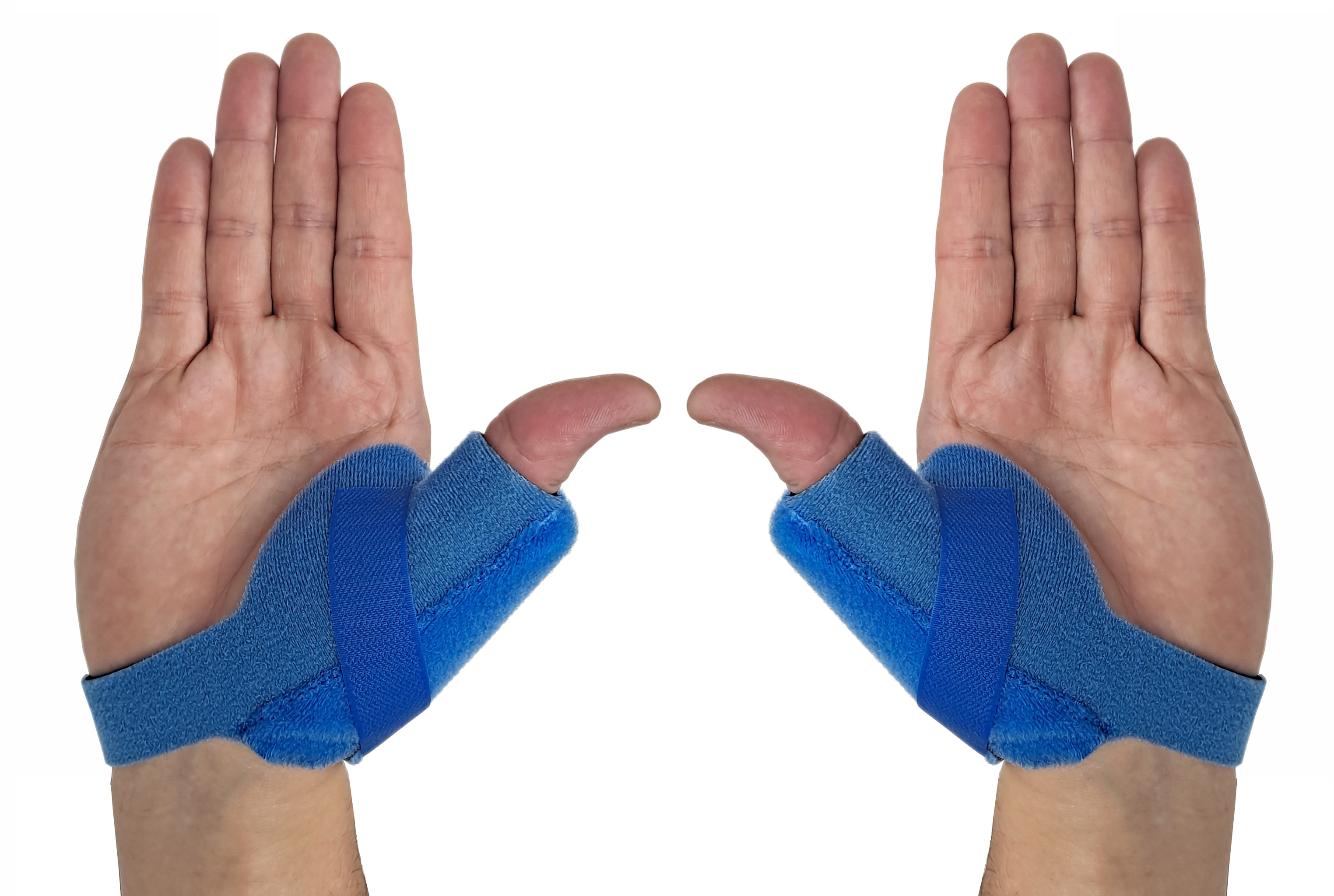 Adult Thumb Splint for Cerebral Palsy, Stroke, M.S., Injury - McKie Splints
