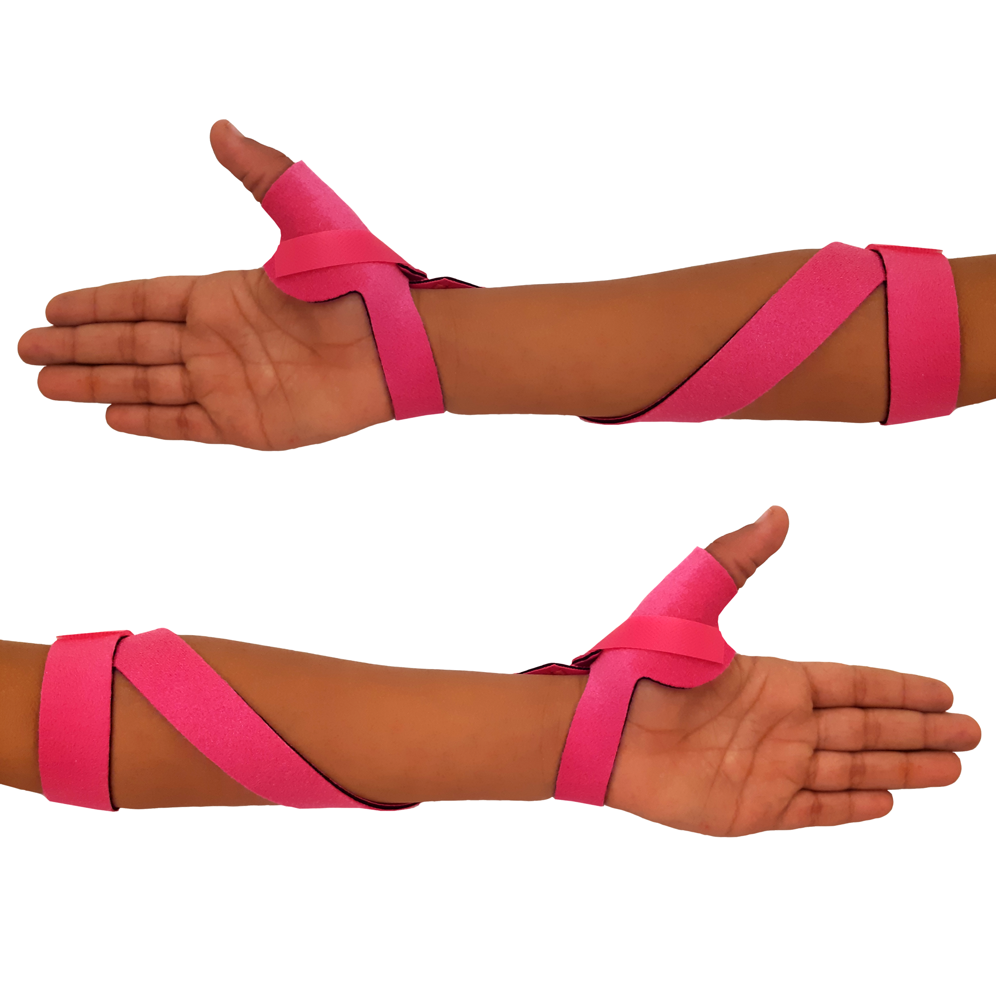 McKie Supination Strap & Thumb Splint Bundle (Pediatric Sizes) - McKie ...