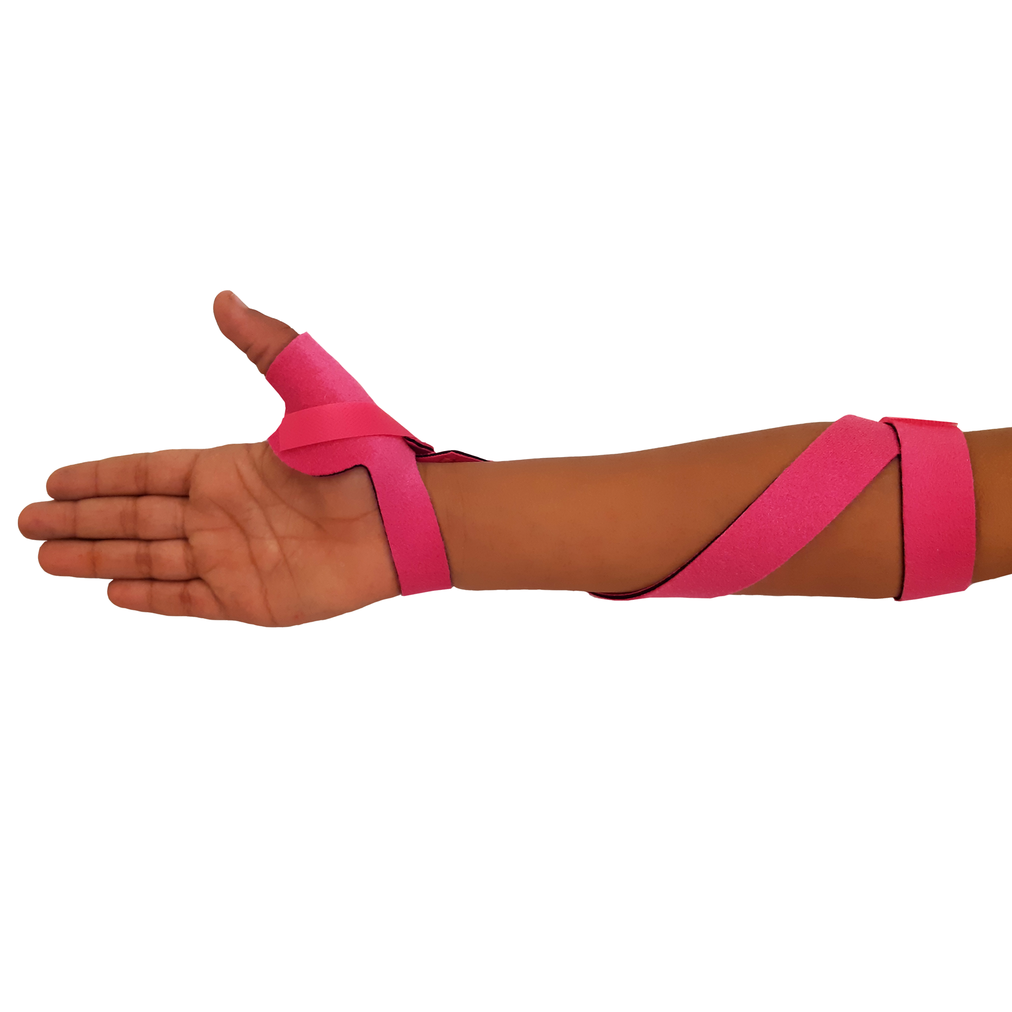 McKie Supination Strap & Thumb Splint Bundle (Pediatric Sizes) - McKie ...