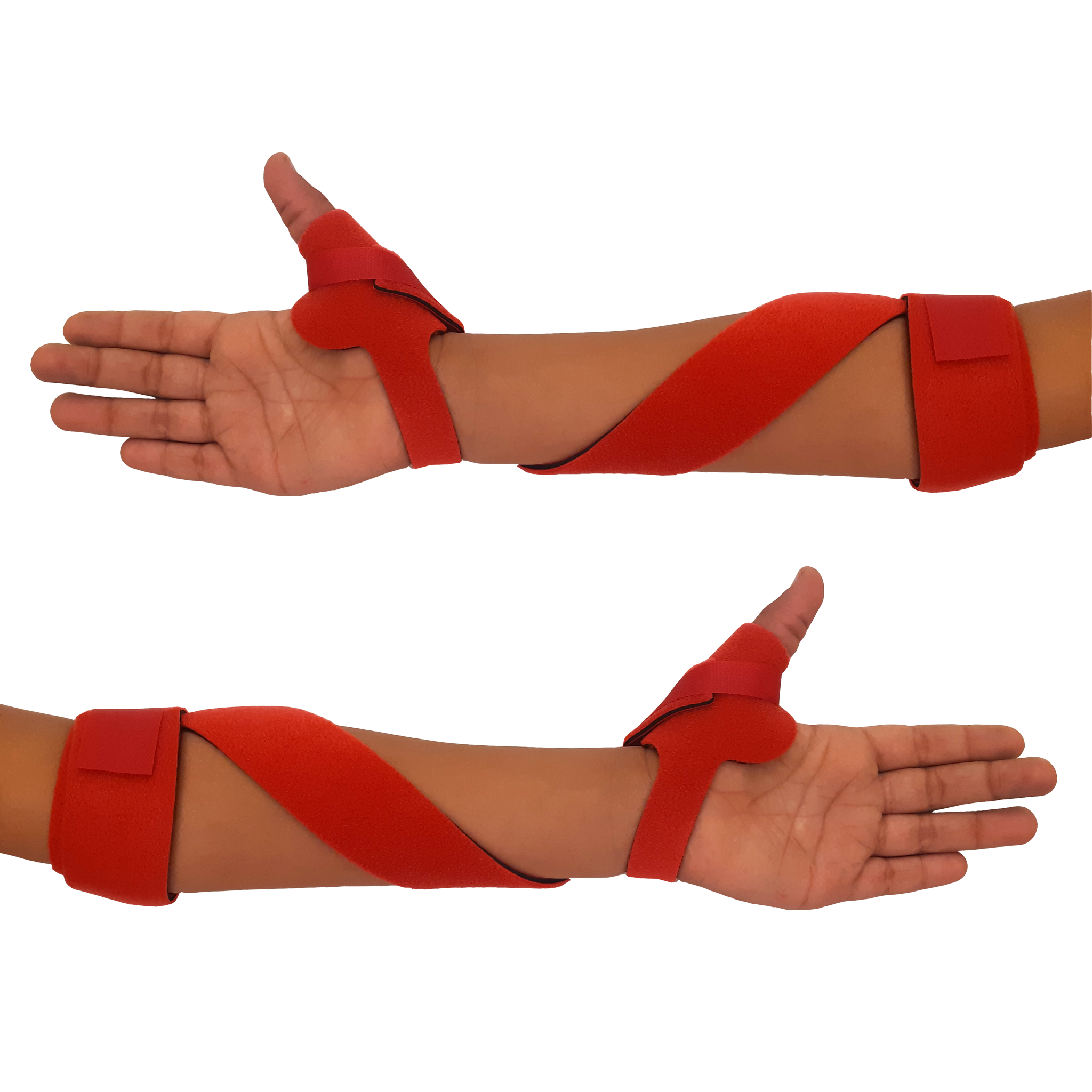 McKie Supination Strap & Thumb Splint Bundle (Pediatric Sizes) - McKie ...
