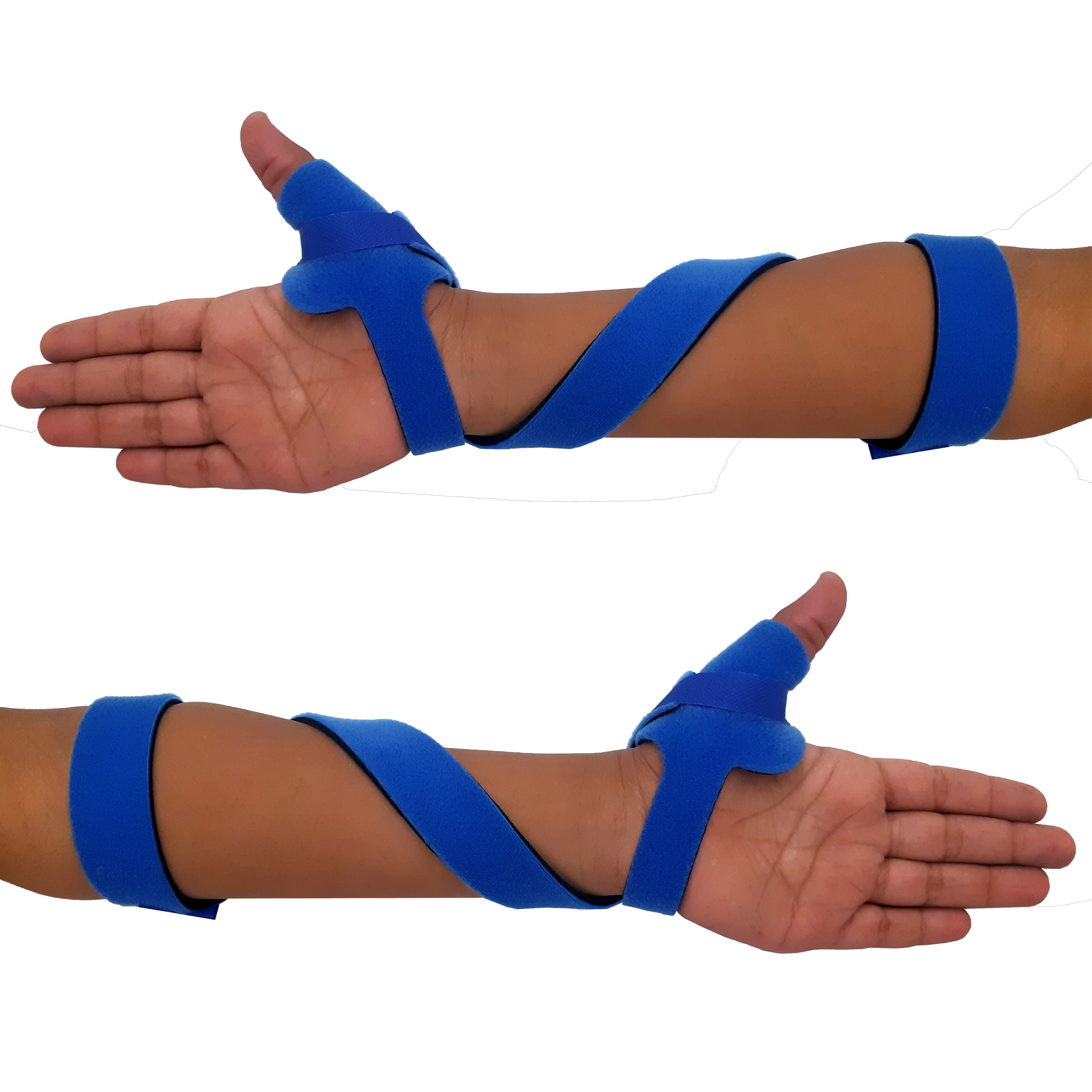 McKie Supination Strap & Thumb Splint Bundle (Pediatric Sizes) - McKie ...