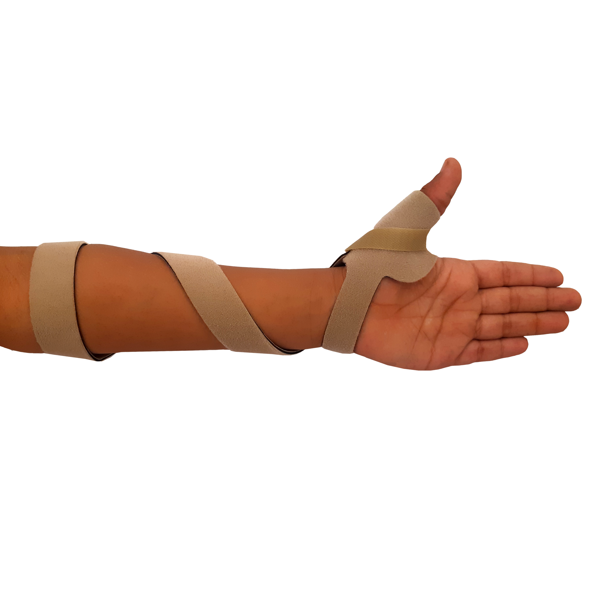 McKie Supination Strap & Thumb Splint Bundle (Pediatric Sizes) - McKie ...