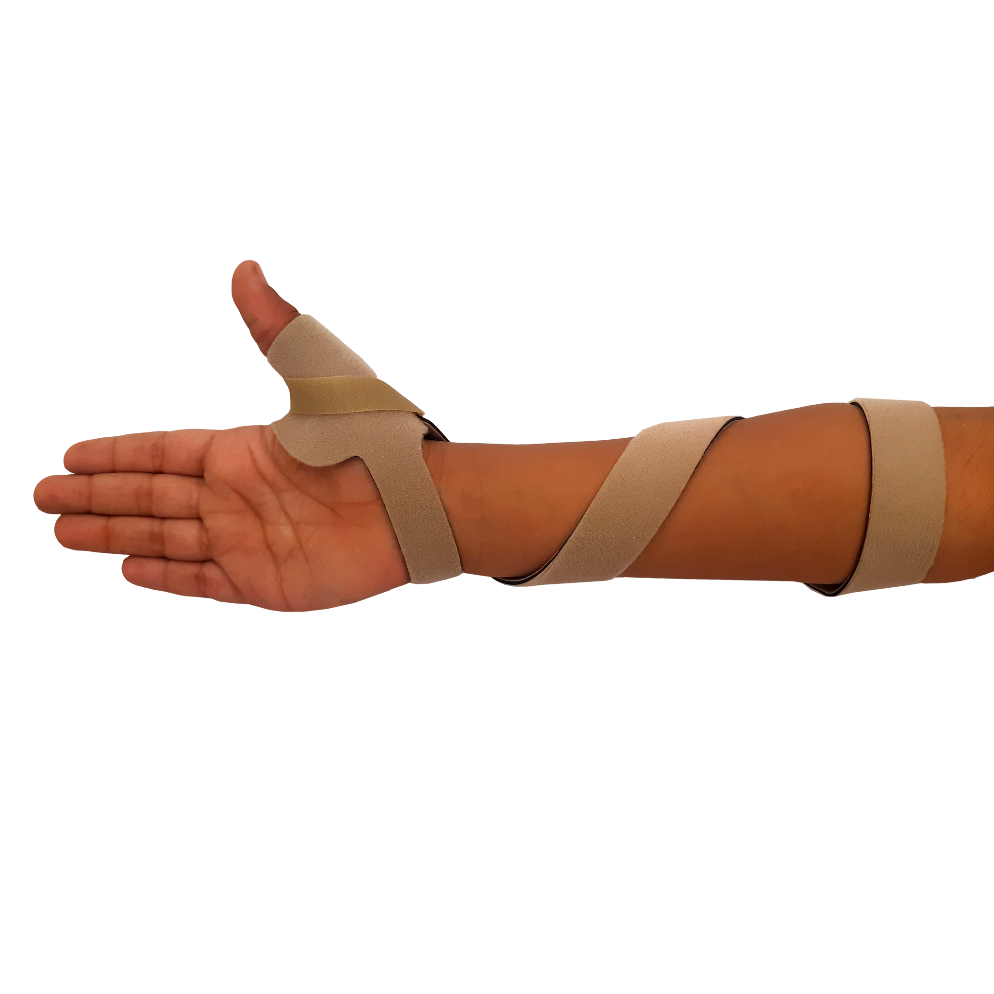 McKie Supination Strap & Thumb Splint Bundle (Pediatric Sizes) - McKie ...